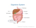 Appendiceal Endometriosis – Extrapelvic Not Rare