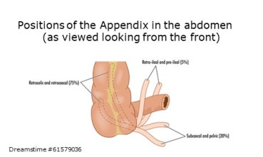 Appendix And Ovary Location In Women What Does The Appendix Do & Other