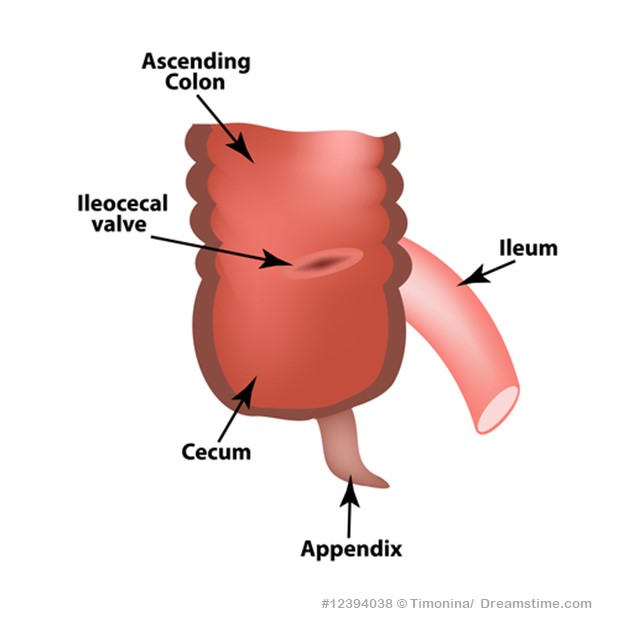 Appendiceal Endometriosis – Extrapelvic Not Rare